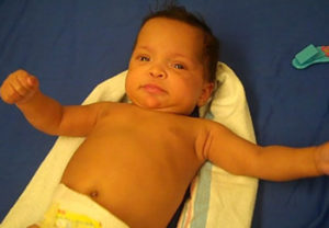 Developmental strategies for the preterm baby in the first year ...